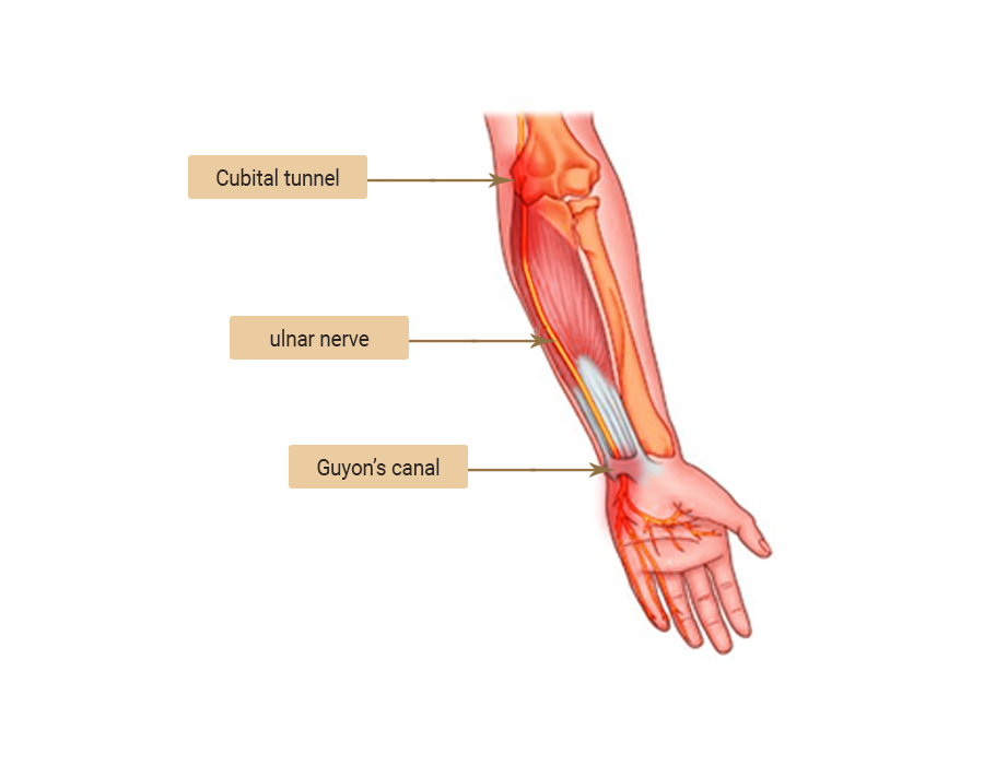London Upper Limb Surgery