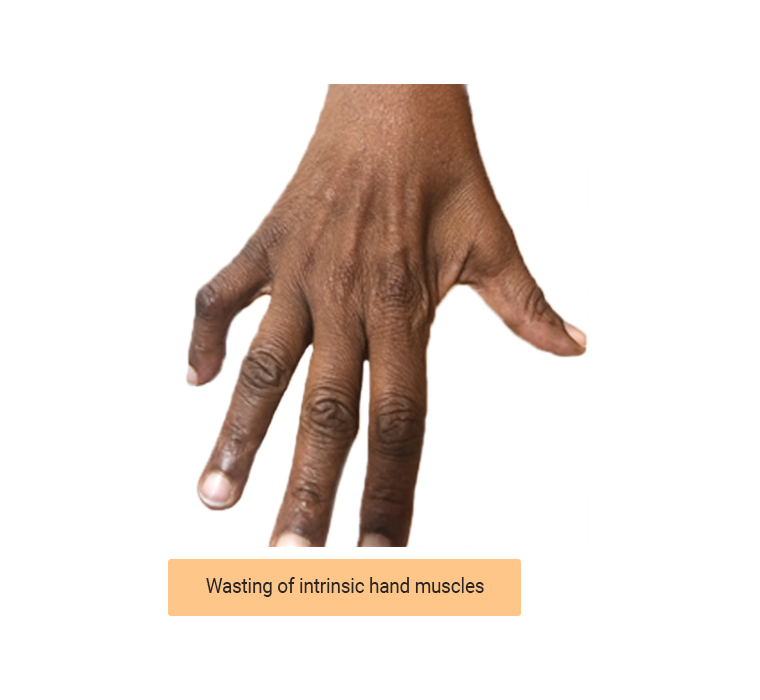 London Upper Limb Surgery