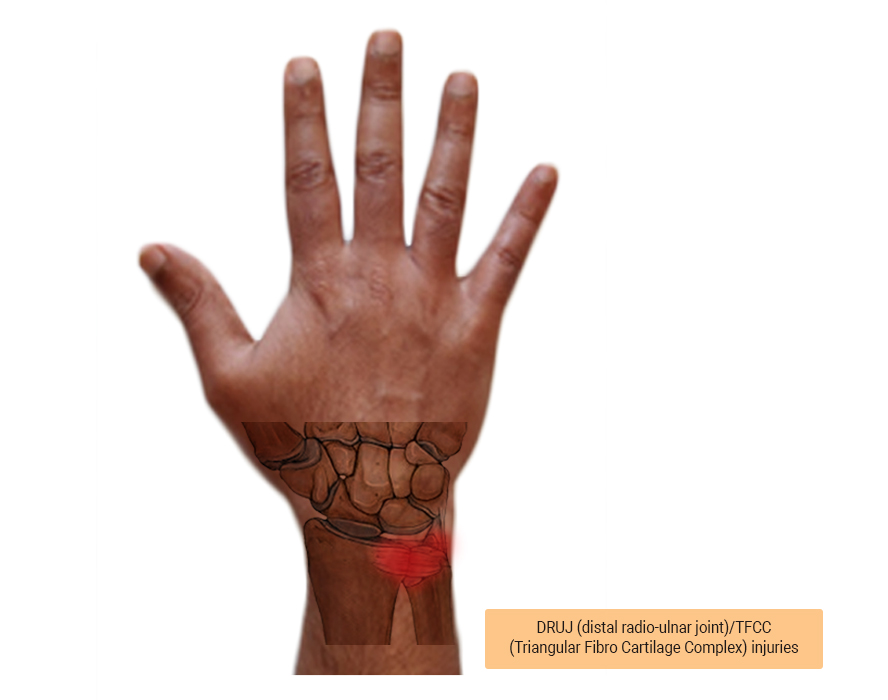 London Upper Limb Surgery