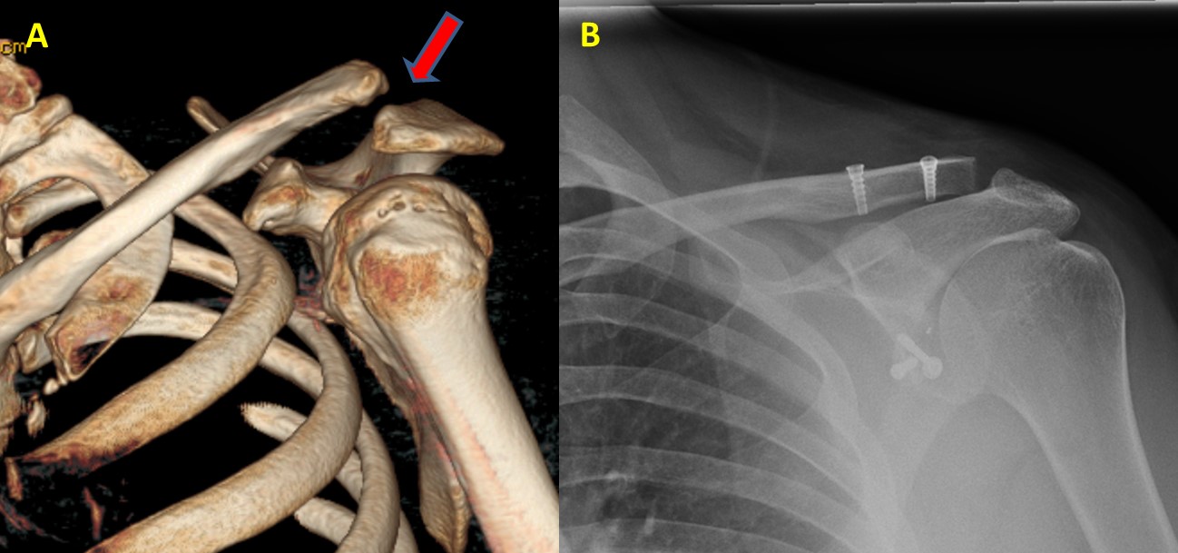 London Upper Limb Surgery