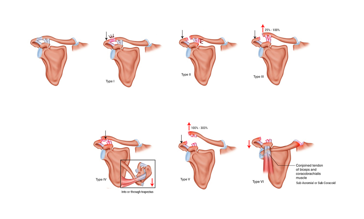 London Upper Limb Surgery