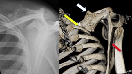 London Upper Limb Surgery