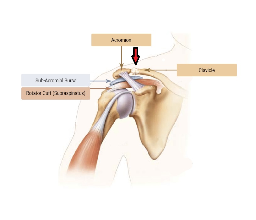 Proximal Distal Anatomy Distal Clavicle Osteolysis